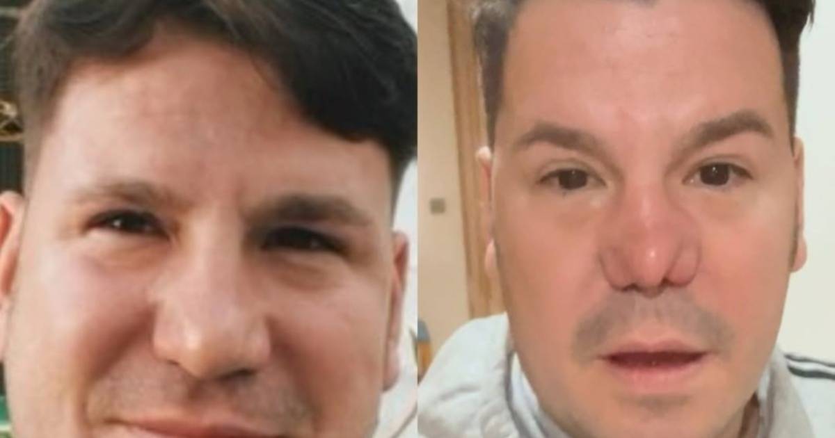 Cantante de "Andy y Lucas" es criticado en redes sociales por mala ...