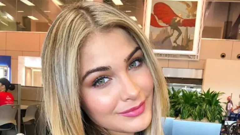 Migbelis Castellanos Antes Y Despues