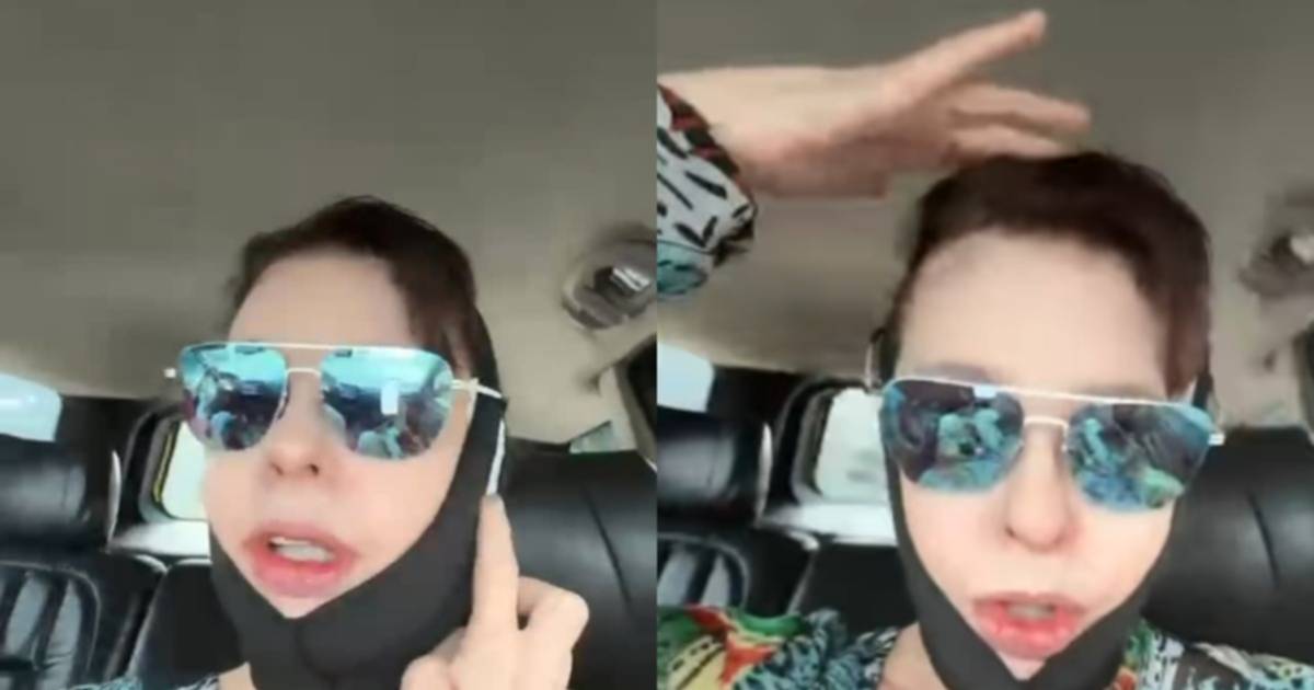 Mimí Lazo con nueva cara: "Saliendo del doctor"